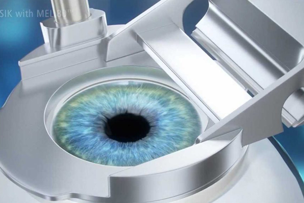 Refractive Surgery 360